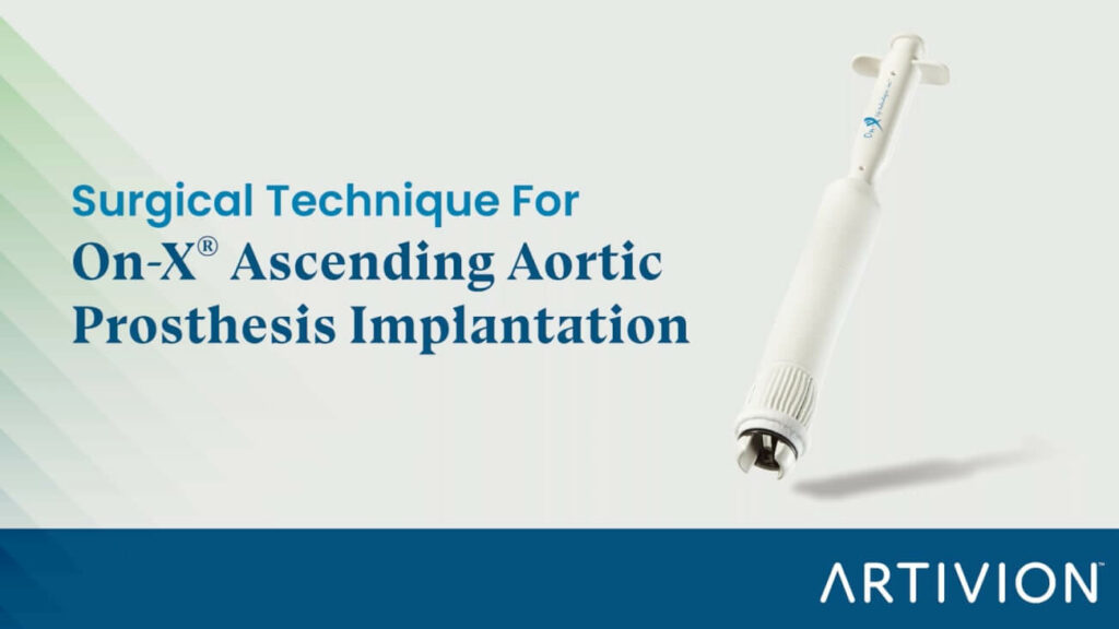 Surgical Technique for Aortic Root Enlargement – Heart Valve Resources